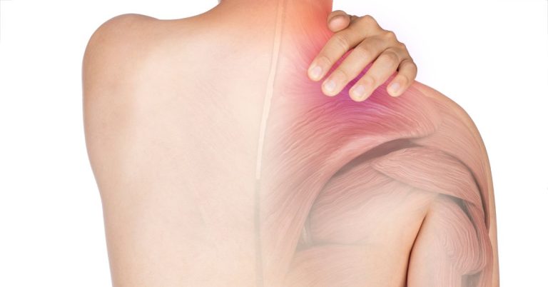 7 Powerful Insights About Polymyositis You Should Know