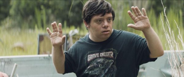 10 Famous Celebrities Who Use A Wheelchair